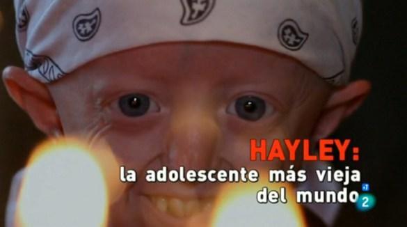 Sección visual de Hayley, la adolescente más vieja del mundo (TV ...