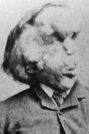 Joseph Merrick - FilmAffinity
